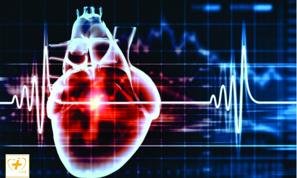 MỤC ĐÍCH CỦA ĐO ĐIỆN TIM